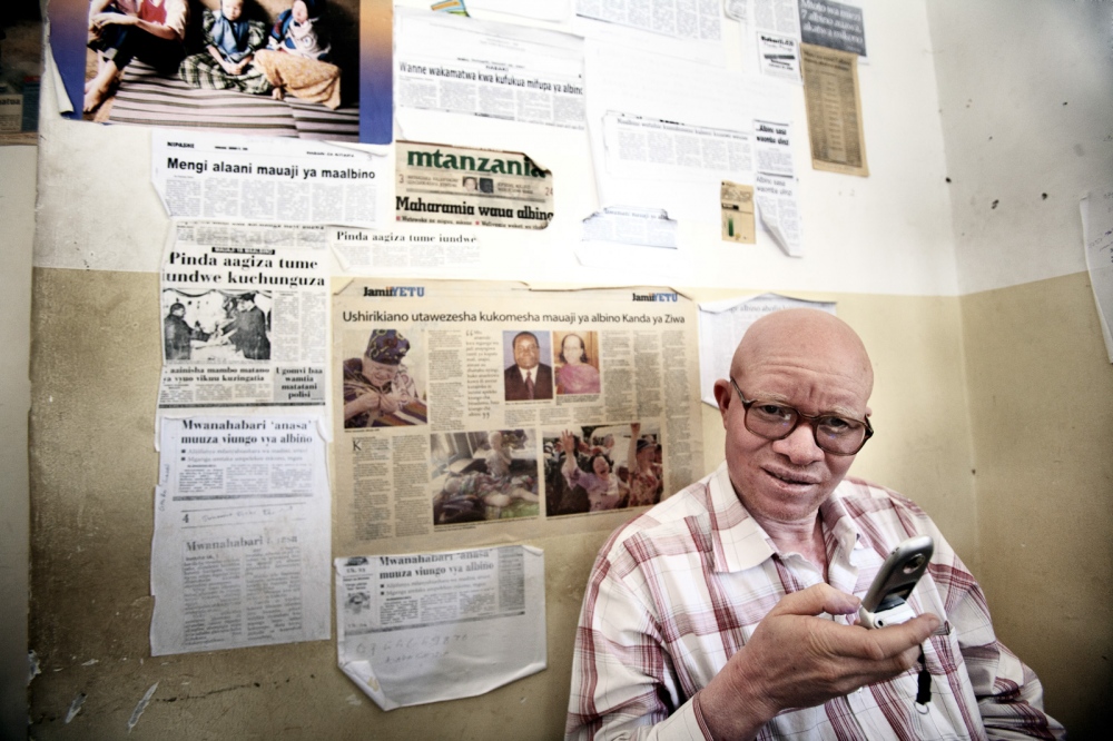 Cursed Skin by David Rengel