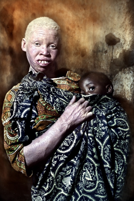 Cursed Skin by David Rengel